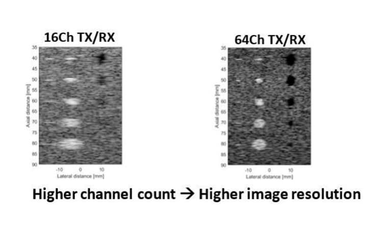 High-Quality Veterinary Ultrasound Image System | Microchip Technology